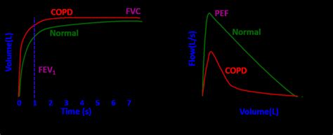 Typical Spirometric Flow Curves A Volume Time Curve And B Download Scientific Diagram