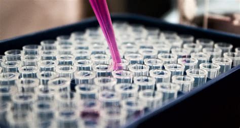 What Is The Difference Between Estimate And Quote Difference Digest