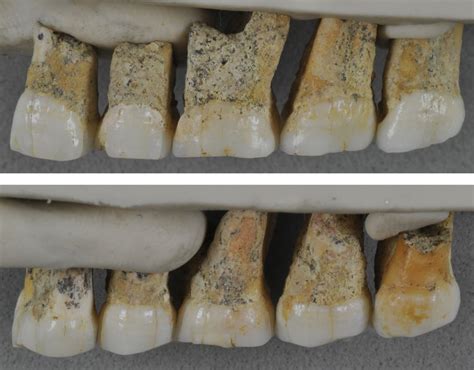 50000 Year Old Fossils In The Philippines Hint At A New Species Of