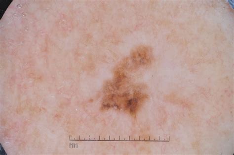 Examples Of Model Outputs When Using Different Pre Trained Feature Download Scientific Diagram