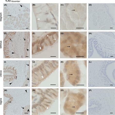 The Histological Structure Of The Turtle Oviduct After Hande Staining Download Scientific