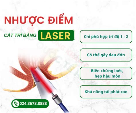 Pp Dtr Tri Laser