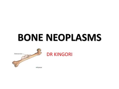 11 Bone Neoplasms In Medical Pathology Pptx