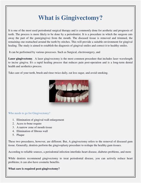 Ppt What Is Gingivectomy Powerpoint Presentation Free Download Id