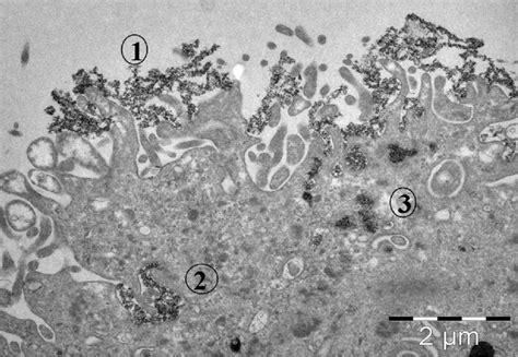 2 Ctem Image Showing The Different Stages Of Cell Internalisation For