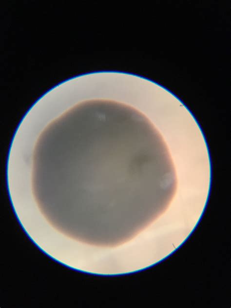 2212024 Blog Post Week 5 Micrococcus Luteus