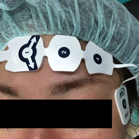 The Bispectral Index Bis Monitor Is An Electroencephalographic Eeg Download Scientific The Bispectral Index Bis Monitor Is An Electroencephalographic Eeg Download Scientific