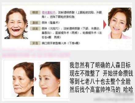 中 년 회춘 성형 할머니가 꽃미녀 됐다 사회 기사 더팩트