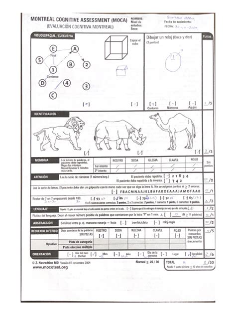 Montreal Cognitive Assessment Moca Pdf
