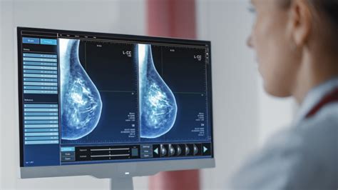 Breast Imaging Software Market To Develop New Growth Story Erad Hologic Ramsoft