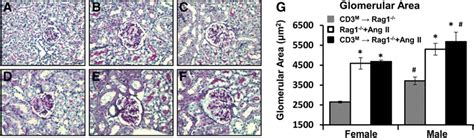 Sex Differences In T Lymphocyte Tissue Infiltration And Development Of Angiotensin Ii