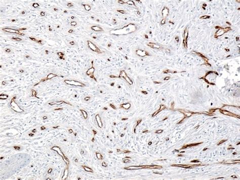 Granulation Tissue In The Deep Dermis During The Maturation Process