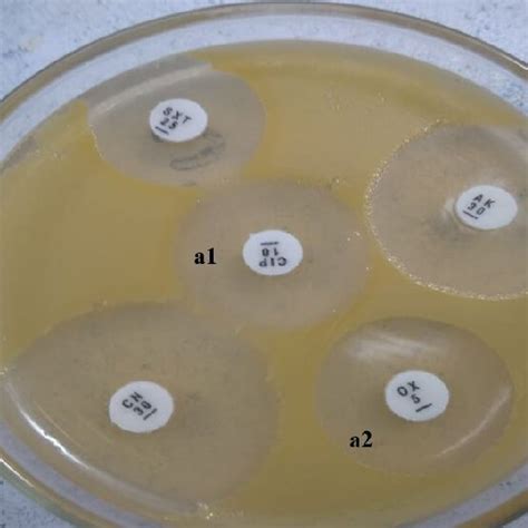 Comparison Of Resistant Intermediate And Sensitive Biofilm Positive