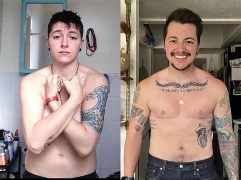 Transgender Ftm