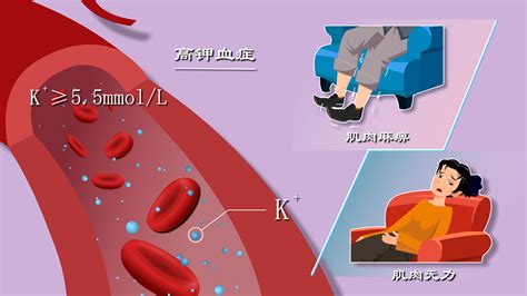 深读视频—以动漫形式科普疾病知识