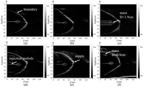 Applied Sciences Special Issue Ultrasound B Mode Imaging
