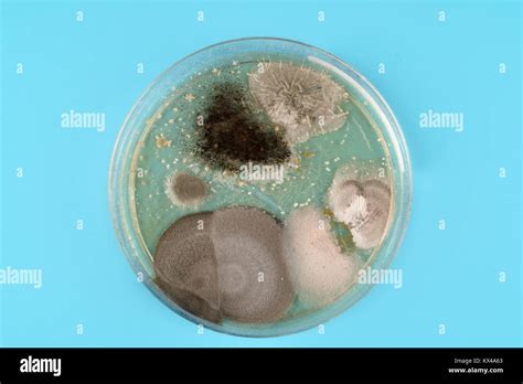 Microorganisms Yeast