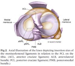 Ligamento De Wrisberg Anatomy23 Meniscofemoral Ligament Wrisberg