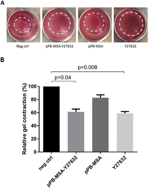The In Vitro Effect Of Ppb Msa Y27632 As Determined By A Contraction