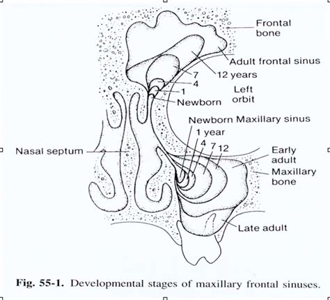 Oral Maxillofacial Surgery Frontal And Maxillary Sinus Development Age