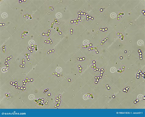 Yeast Cells In Urine