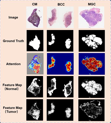Visualization Of Results The Segmentation Results Can Provide The
