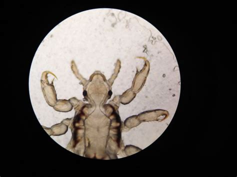 Lice Under Microscope