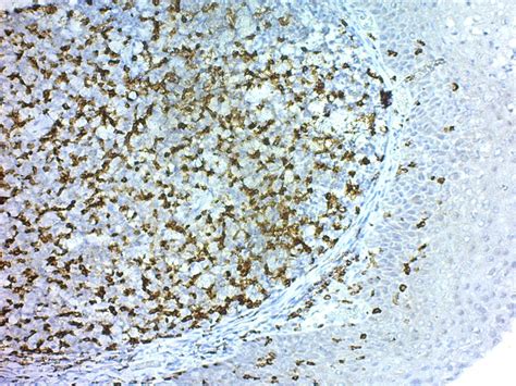 Rabbit Specific Hrpdab Detection Ihc Detection Kit Ab236469 Abcam