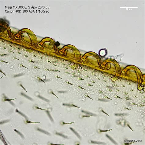 Microscopy Forum Microbehunter Microscopy Magazine Microbehunter Microscopy Magazine