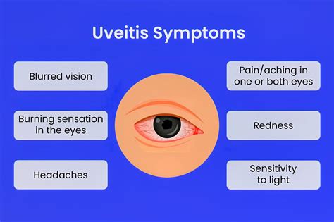 Uveitis Clinical Notes For Medical Students