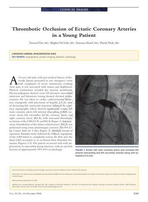 Pdf Thrombotic Occlusion Of Ectatic Coronary Arteries In A Young Patient