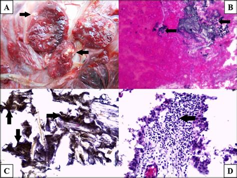 Placenta A Caseous Lesion B Severe Fibrinoid Necrosis And Download Scientific Diagram