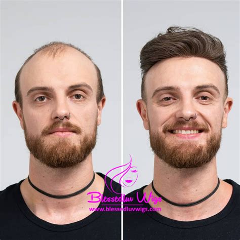 Richard Lace Base Men Toupee Artofit