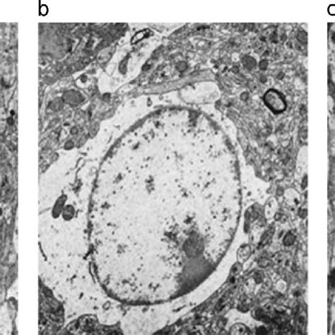 Transmission Electron Micrograph Of Brain Cell A Control B Low Download Scientific Diagram