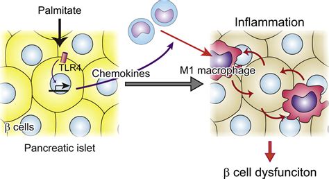 Saturated Fatty Acid And Tlr Signaling Link β Cell Dysfunction And Islet Inflammation Cell