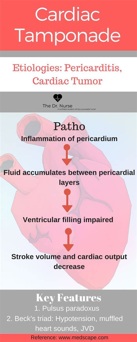 Cardiac Tamponade Etiologies Pathophysiology And Key Features Nursing Nursing School