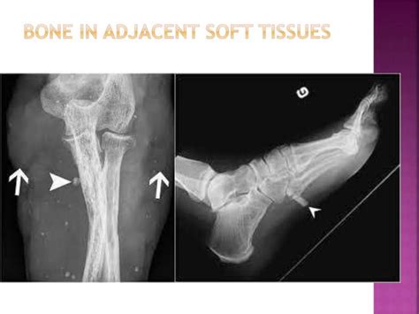 Soft Tissue Radiography By Virendra Kumar Maurya Pptx