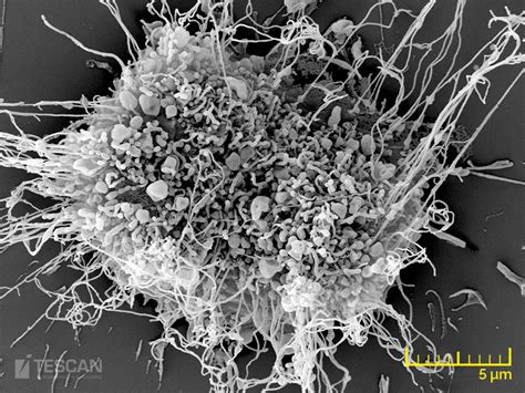 5 Science Facts Behind Astonishing Electron Microscope Images Rs Science