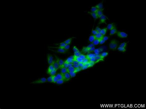 Map2 Antibody 84306 4 Rr Proteintech