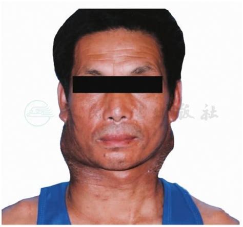 疾病详情 疾病 人卫临床助手 人民卫生出版社