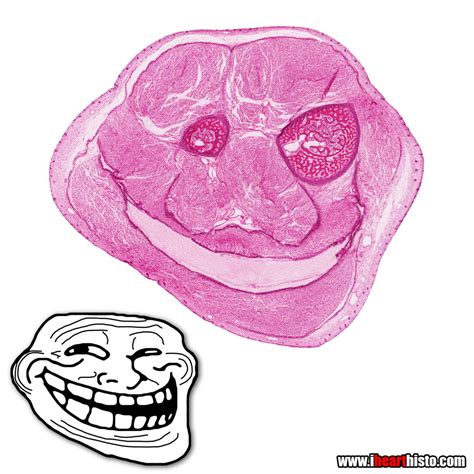 Connective Tissue Memes