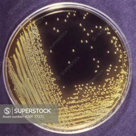 Vibrio Cholerae Photomicrograph Of Colonies Of Vibrio Cholerae