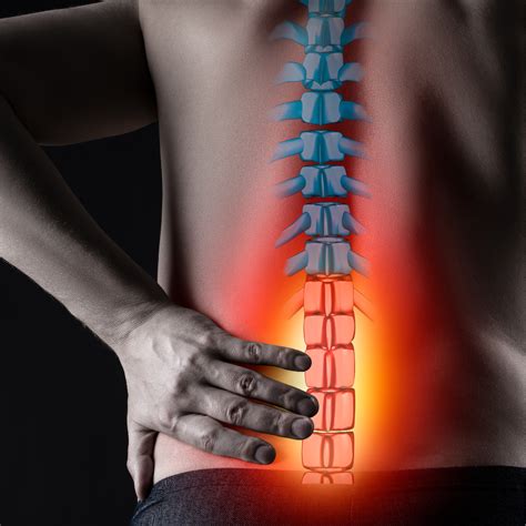 Physical Therapy And Sciatica Recovery Results Rehabilitation