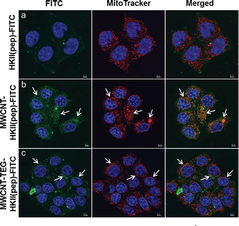 Figure 1 From Mitochondria Acting Hexokinase Ii Peptides Carried By