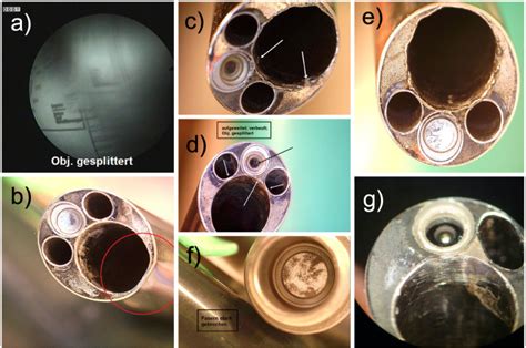 Durability Of Endoscopes Used During Routine Lumbar Endoscopy An