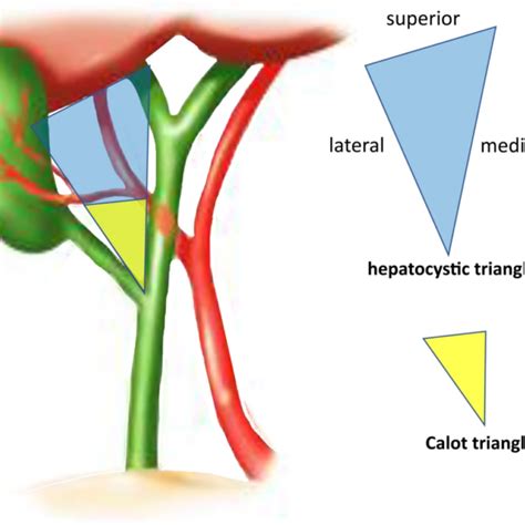 Gallstones Biliary Colic Cholecystitis Geeky Medics