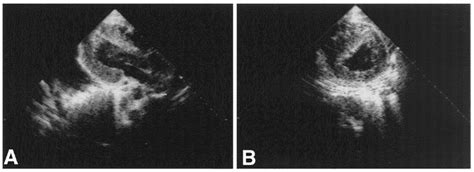 A Review Of The Role Of Imaging Modalities In The Evaluation Of Viral
