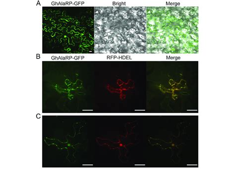 Subcellular Localization Of Ghalarp A Transiently Expressed