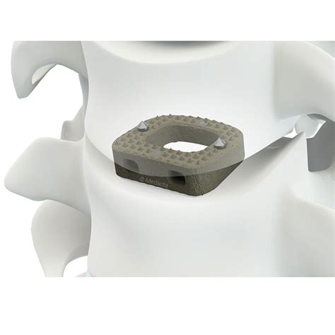 Mecta C Cage Yourspine Implantes E Material Cirúrgico
