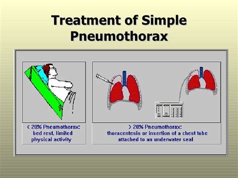 Respiratory System 2